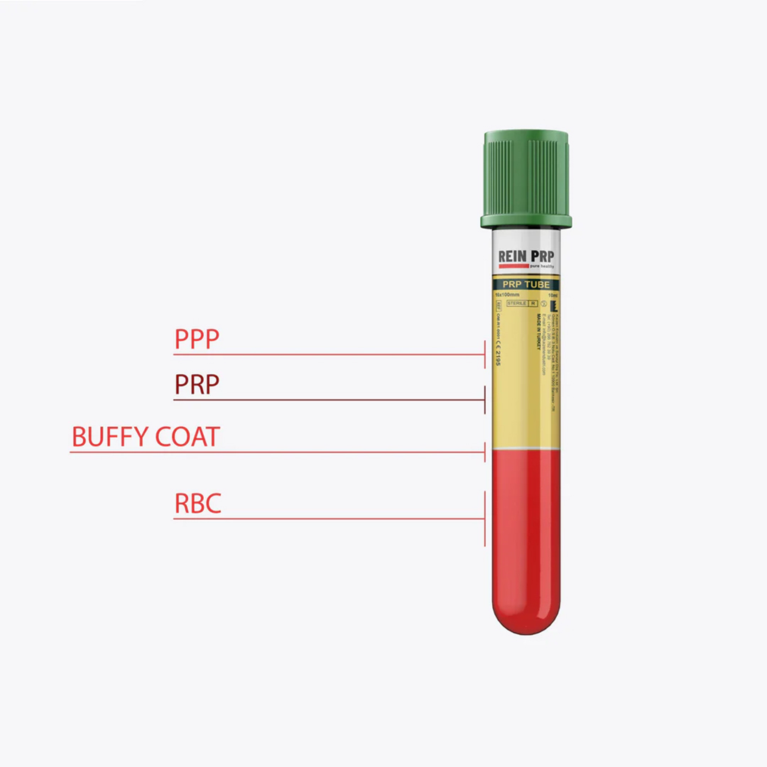 لوله PRP REIN - آریا اکسیر